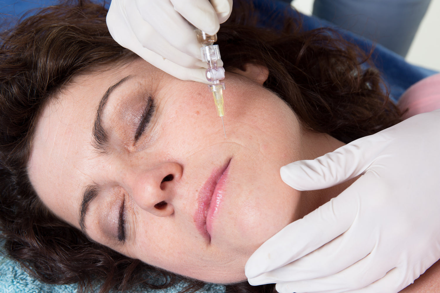 How to Cover Up a Facial Bruise From Cosmetic Procedures – Zax's Original